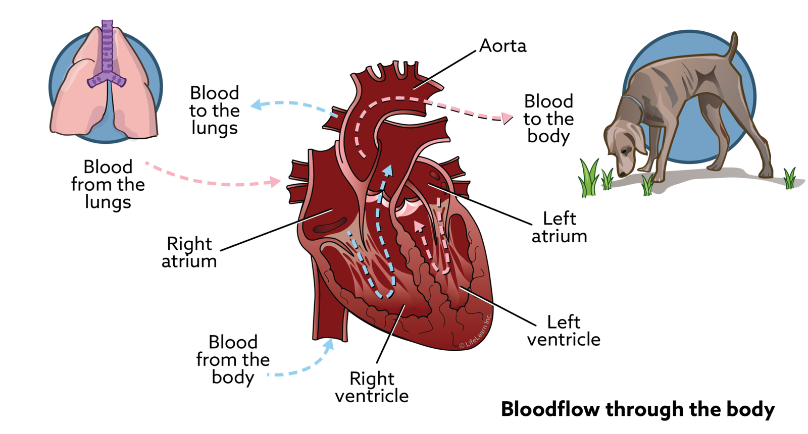 Patent Ductus Arteriosus (PDA) – SPA DU MAROC